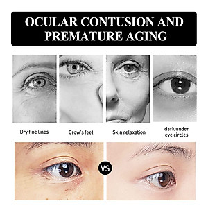 Jaysuing Collagen Boost Anti-Aging Serum Firming Eye Cream, Collagen Boost Anti-Aging Serum, Verfons Firming Eye Cream for Bags, Fades Fine Lines and Wrinkles (3PCS)