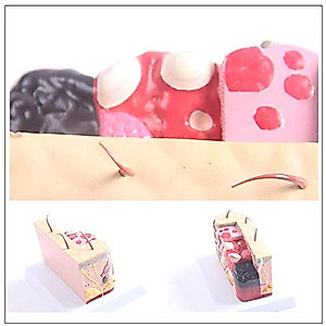 Anatomy Model Skin - Human Burn Skin Anatomy Model -Medical Anatomical Skin Model - for Study Display Taching Medical Model,Medical Educational Aid