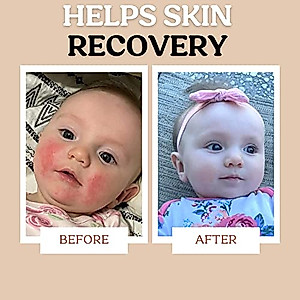 Roe Wellness Baby Biome Barrier Cream Maximize Hydration Protect Skin & Build Soft Healthy Skin Protect & Lock In Moisture