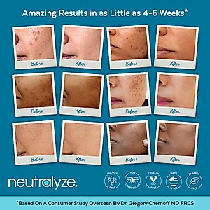 Brightening Dark Spot Corrector for Face - Maximum Strength Acne Dark Spot Remover, Brightening Serum & Fade Cream - Melasma Treatment for Face with Vitamin C, Niacinamide & Arbutin (90+ Day)