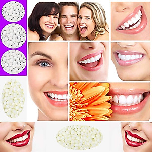 Teeth Repair Kit, Temporary Teeth replacement kit, Moldable False Teeth, Thermal Fitting Beads for Snap On Instant and Confident Smile, with Mouth Mirror, Mouth Tweezer, Dental Probe
