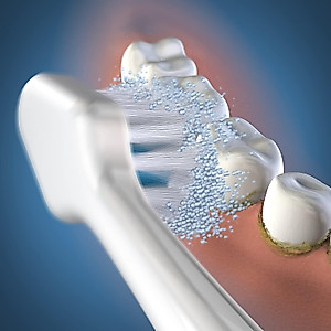 Waterpik Triple Sonic Tooth Brush Heads Replacement, Complete Care, STRB-3WW, 3 Count (Pack of 1), White