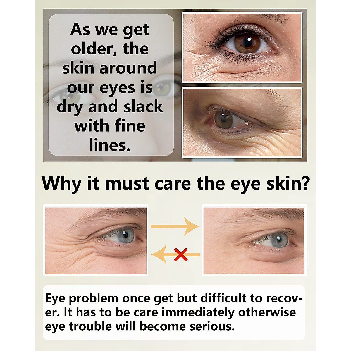 Under Eye Patches (60Pcs) - Upgraded Eye Mask Retinol & Collagen, Eye Treatment Mask, Under Eye Bag Treatment, Eye Masks for Puffy Eyes, Anti-Aging, Anti-Wrinkle and Fine Lines, Under eye Dark Circles