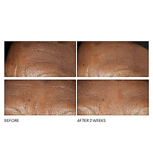 Dr Dennis Gross Advanced Retinol + Ferulic Intense Wrinkle Cream | Intensely Hydrating to Visibly Transform Skin and Repair the Moisture Barrier | 2 oz