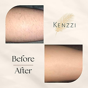 Kenzzi IPL Hair Removal Handset for Women & Men: Pain-Free & Long-lasting Solution for Body & Face Hair Removal, An Alternative to Salon Laser Hair Removal Treatments, Permanent Results