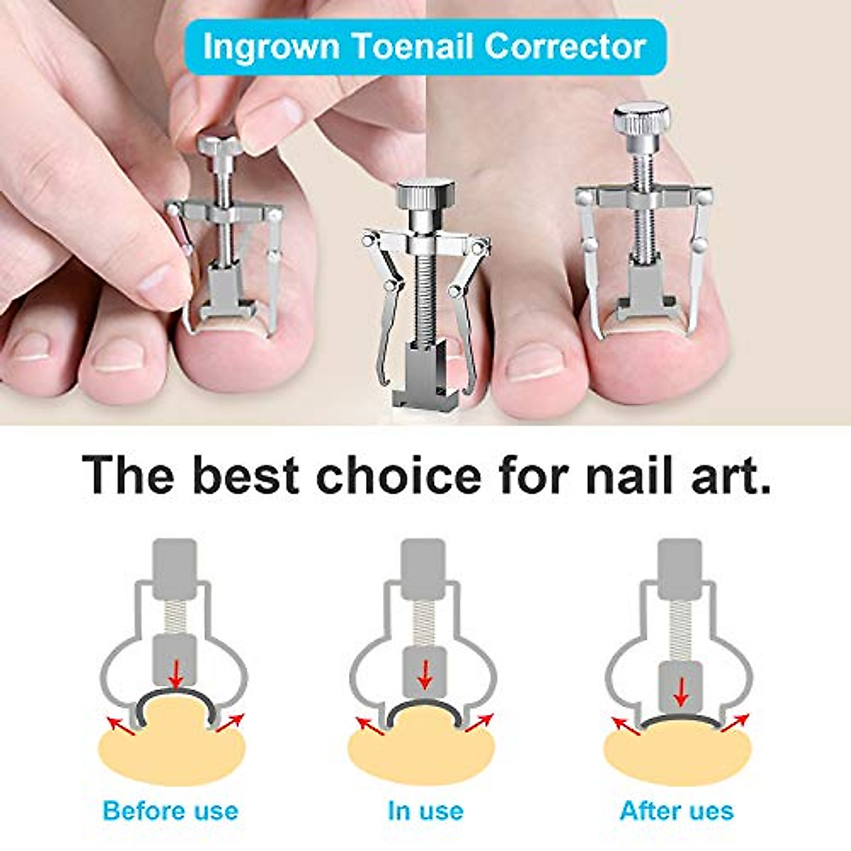 Upgraded Ingrown Toenail Tools 9pcs, TENBOK Professional Podiatrist Toenail Clippers for Thick, Ingrown & Side Nails for Men & Seniors, Surgery Grade Ingrown Toenail Treatment Pedicure Tool