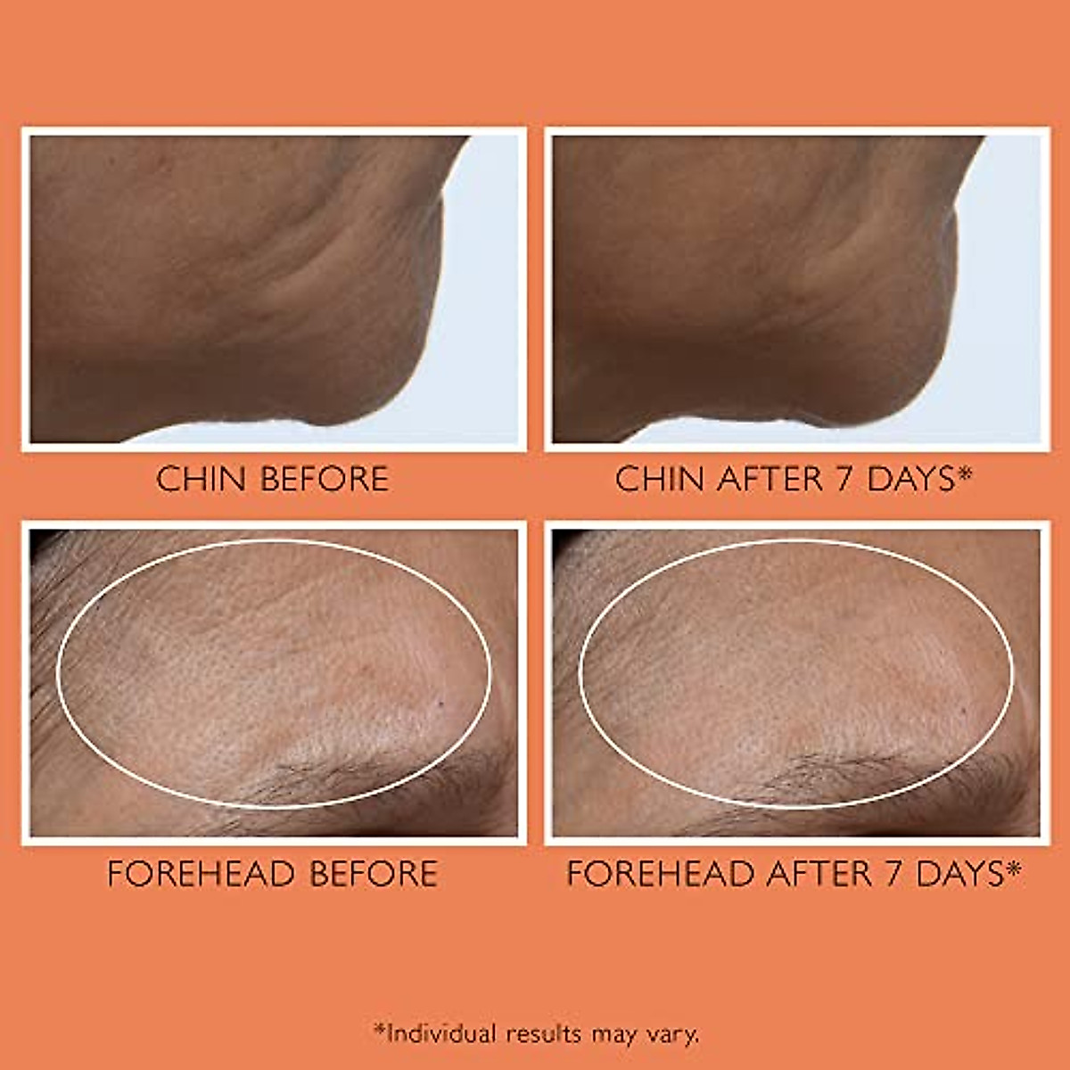 Peter Thomas Roth | Potent-C Bright & Plump Moisturizer | Brightening Vitamin C Moisturizer and Anti-Aging Cream with Collagen light blue 1.69 Fl Oz