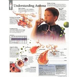 Understanding Asthma chart: Laminated Wall Chart
