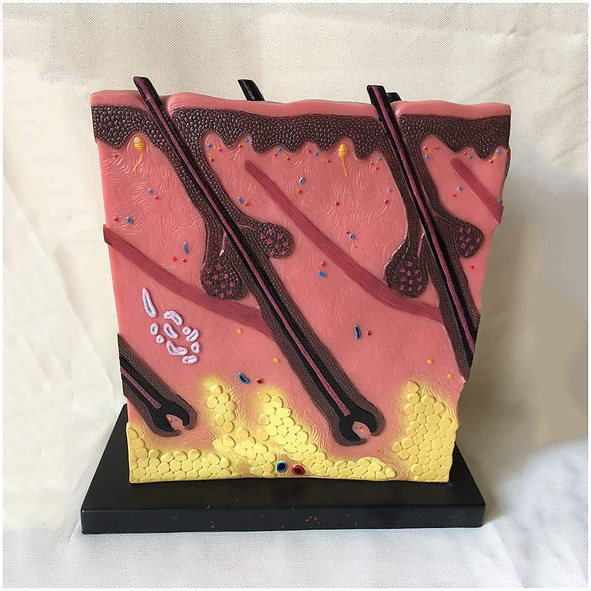 HAILIA Medical Models, Skin Anatomy Model,Hair Follicle Hair Anatomy Model Acne Pustule Blackhead Medical Teaching Model,for Medical Educational Training Aid,Study Display