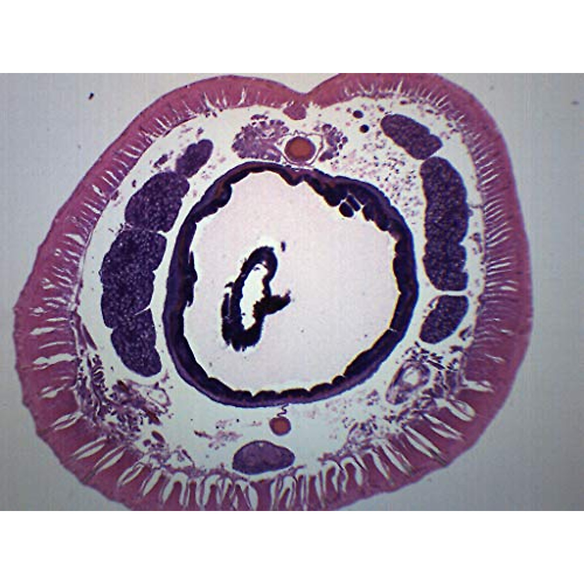 Earthworm Setae, Cross Section - Prepared Microscope Slide - 75 x 25mm - Biology & Microscopy - Eisco Labs