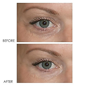 Dermelect Revitalite Professional Eyelid & Dark Circle Corrector for Eyes - Anti Aging Cream with Peptides Brightening & Tightening Treatment for Dark Circles, Puffiness, Droopy Eyelids, Wrinkles