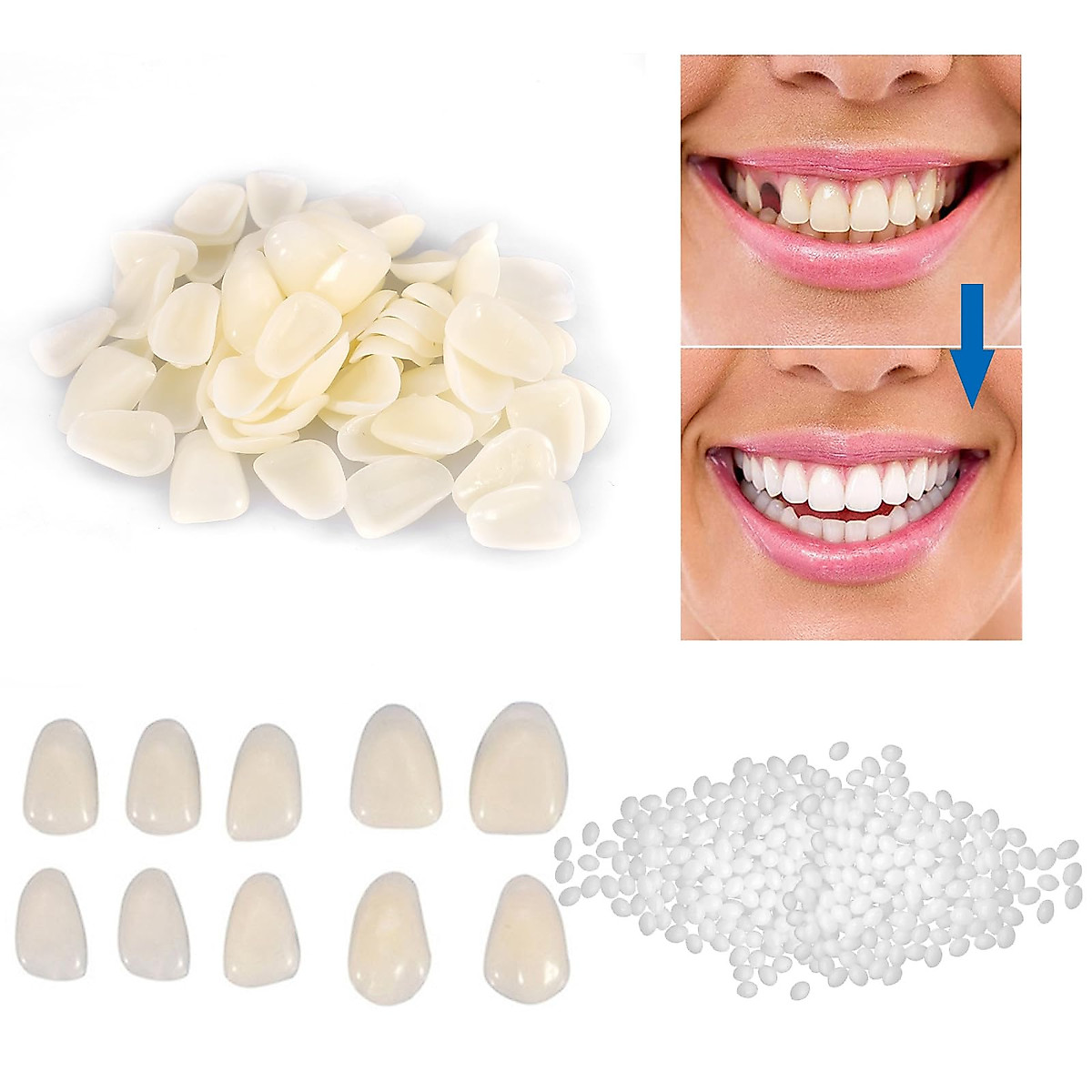 100 Pcs A2 Color Dental Temporary Crown Veneers - Tooth Repair Kit for Missing & Broken Teeth, Orthodontic Care Solution - Temporary Fake Teeth Replacement Set