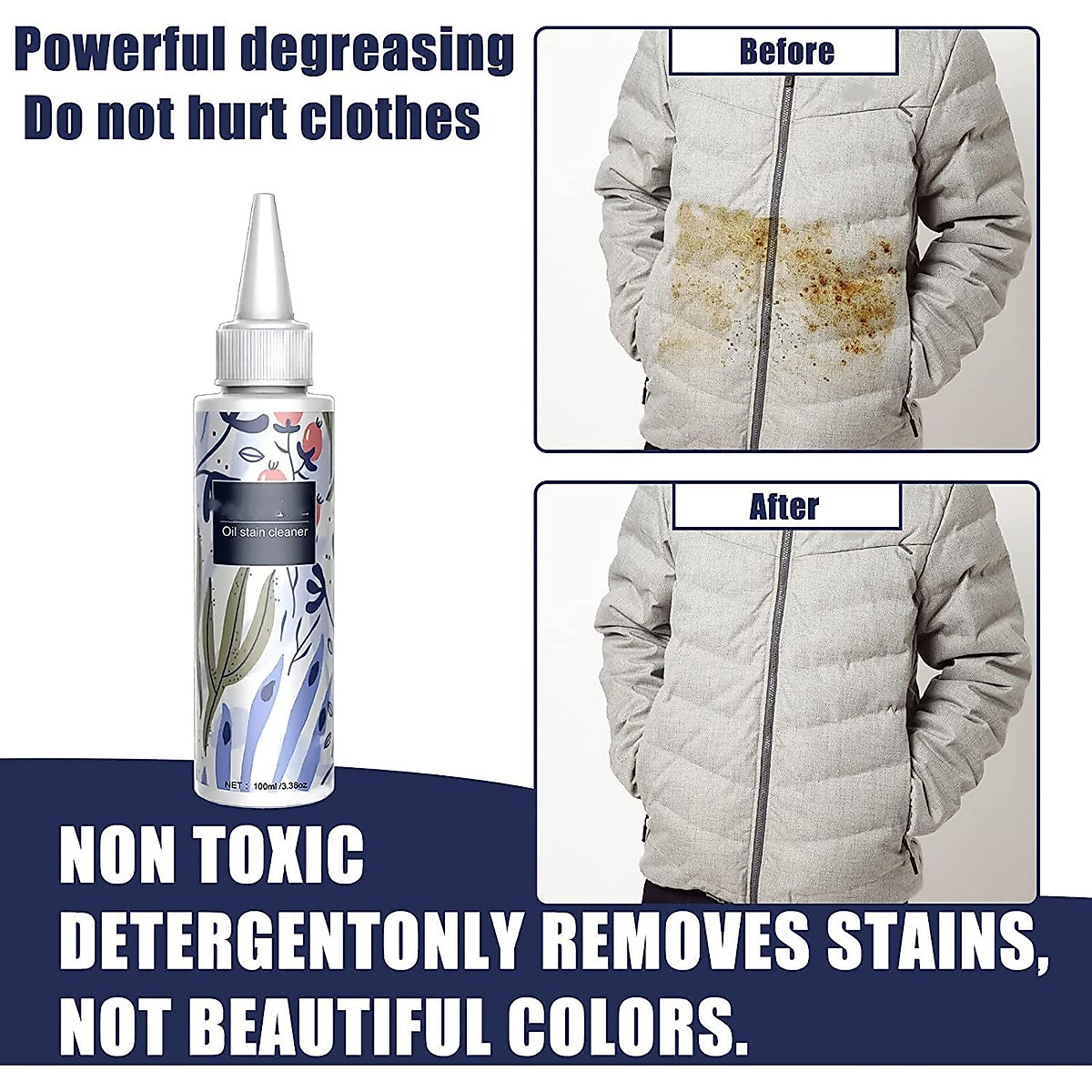 100ml Clothes Grease Stain Remover Nml Clothes Grease Stain Remover, Clothes Grease Stain Remover, Clothes Stain Remover(1 pc)