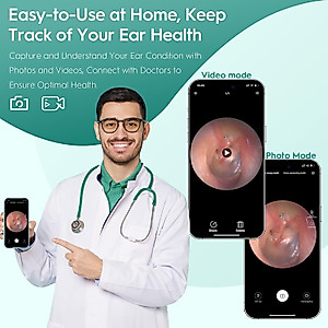 Earwax Camera Ear Camera Otoscope Cleaner, Oxbird 1080P Wireless Ear Wax Removal Kit Smart Ear Cleaner with Camera and Light for iPhone, Ipad & Android Smart Phones (Black)