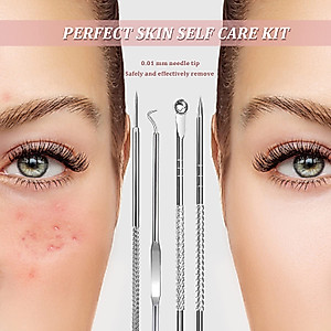 4PCS Blackhead Acne Removal Extractor, Curved Blackhead Tweezers Kit, Professional Stainless Pimple Acne Blemish Removal Tools Kit with Storage Box