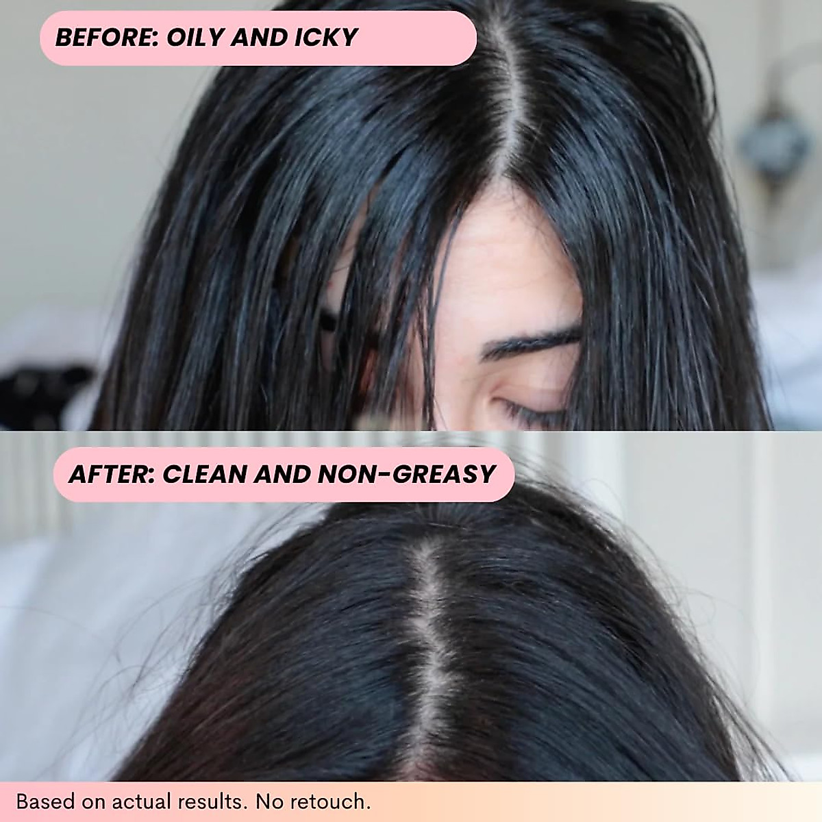 FoxyBae Volumizing Dry Shampoo Spray for Women - With Biotin for Hair Growth - For Dark, Brunette & Blonde Hair - Refreshing & Non-Toxic