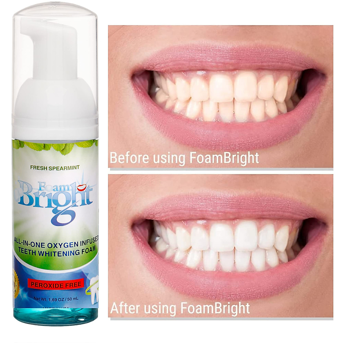 Retainer Cleaner & Aligner Cleaner FoamBright, Great for Invisalign, Teeth Whitening Foam, Candid, Byte, Denture Whitener Toothpaste & Braces Cleaning Peroxide Free Oral Care Replaces Tablets, Paste, Gel
