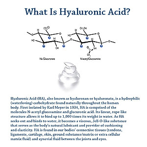 Hyalogic HyaFlex Pro-Complete Dog Joint Supplement, Canine Joint Support – Hyaluronic Acid Joint Supplement for Dogs –w/Glucosamine MSM Supplement 30-60 Day Supply, Cartilage & Coat Supplement