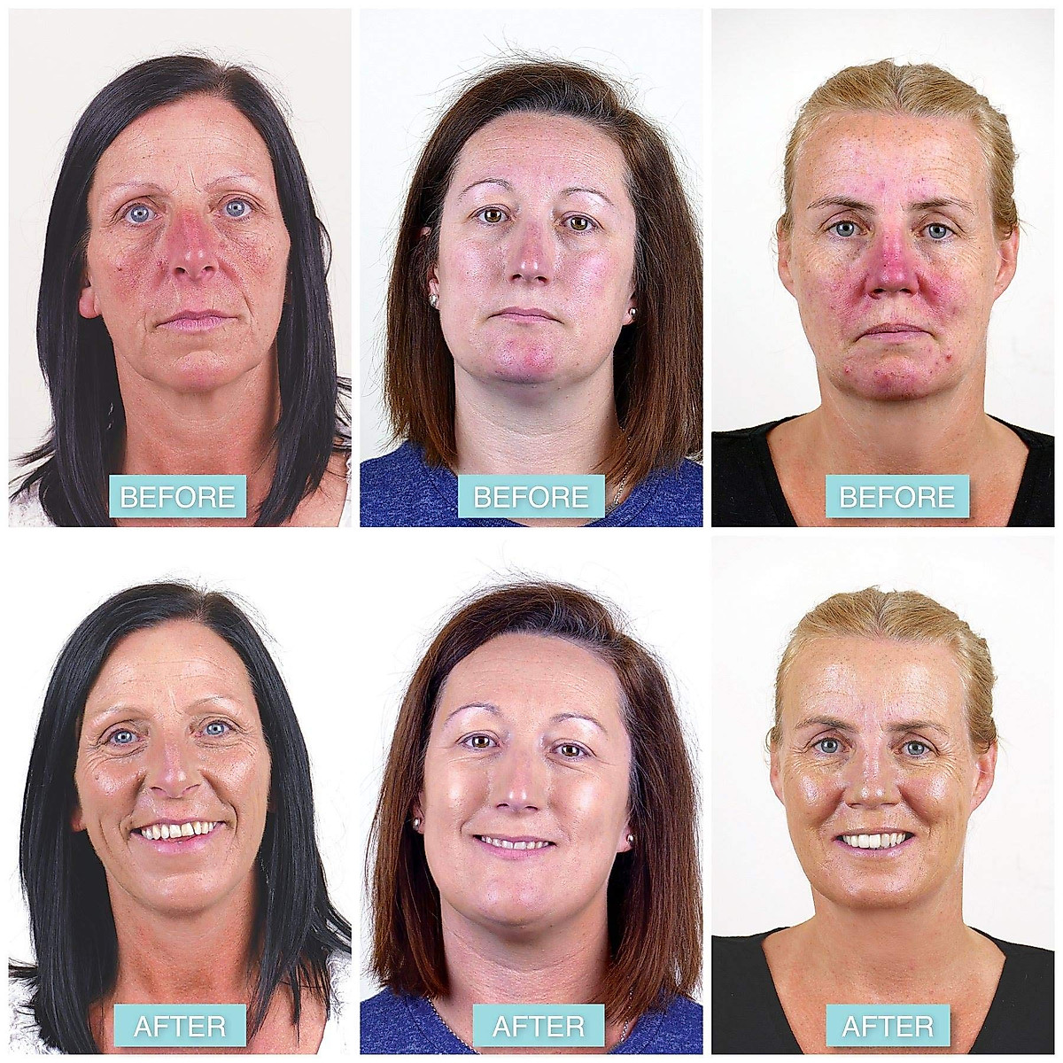 Rosalique 3 in 1 Anti-Redness Miracle Formula SPF50 1 x 30 ml