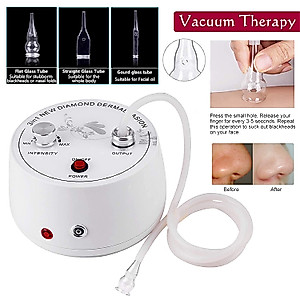 Diamond Microdermabrasion Machine, Yofuly 3 in 1 Professional Microdermabrasion Machine with Vacuum Glass Tube and Spray Bottle for Home Use Skin Care