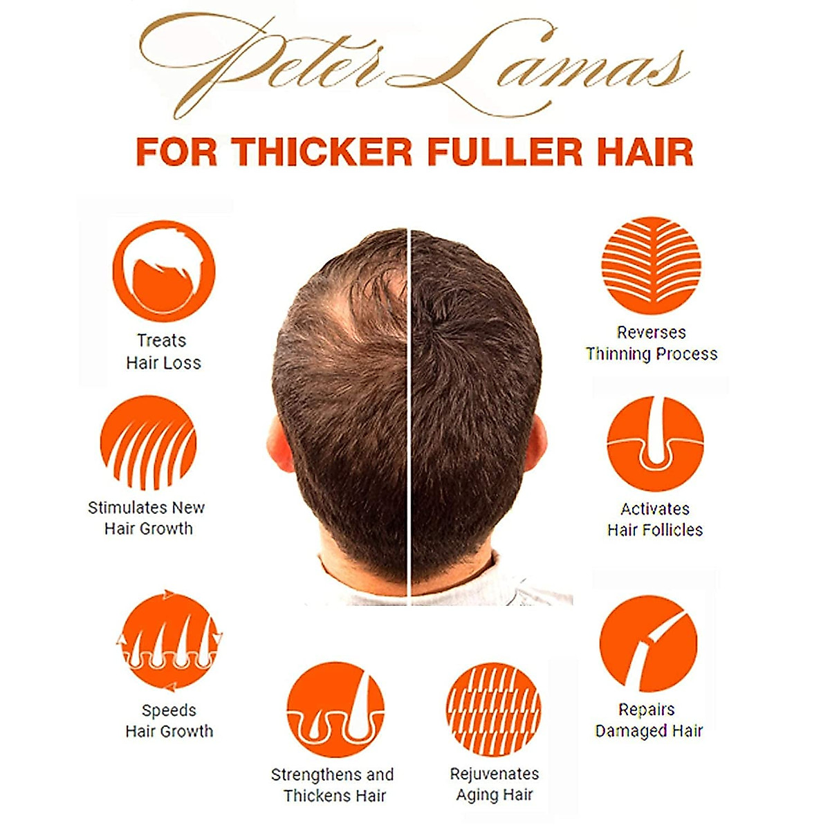 Peter Lamas Biotin Shampoo for Men & Women, DHT Blocker Shampoo, Promotes Hair Growth for Thicker and Fuller Hair, Complete Dry Scalp Treatment with Peppermint Oil for Daily Hair Care