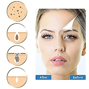 Inlifay Dark Spot Remover for Face Hyperpigmentation Treatment. Dark Spots, Melasma, Freckle, Sun Spots Removal Dark Spot Corrector Cream for Women and Men