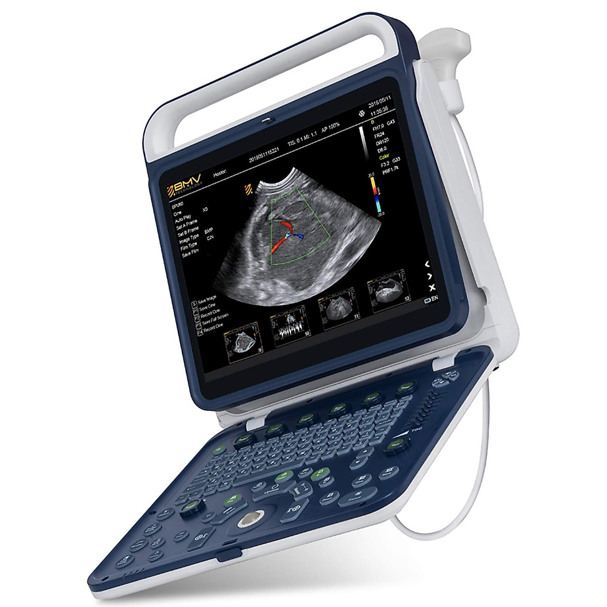 BPU60V Hand-Carried 15" Color Doppler Ultrasound System equine, large animal, small animal, zoo mammal, and marine mammal medicine body scans Abdomen, Reproduction, Gynecology, Cardiology, Small Parts