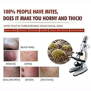 BIOAQUA Acne Scar Natural Blemish Gel Acne Pimple Acne Spot Removal Cream, Oil Control Shrink Pores Face Care Cream