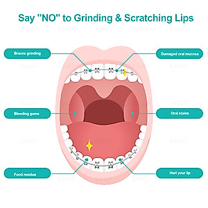 Annhua Orthodontist Wax Brace Wax Flavored 10 Pack, Dental Ortho Dots Wax Strips for Aligners, Braces Wearer, Brackets, Invisible-lingers, 10 Fruit Smell