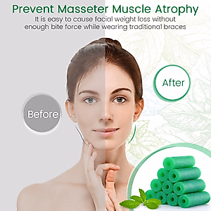 Aligner Chewies for Invisalign Aligners - Mint Scented (20Pcs Chewies) and 2 Aligner Removal Tools