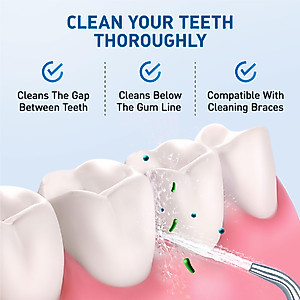 Water Flosser Replacement Tips for Waterpik, Replacement Heads for Waterpik (6 Classic Jet Tips)