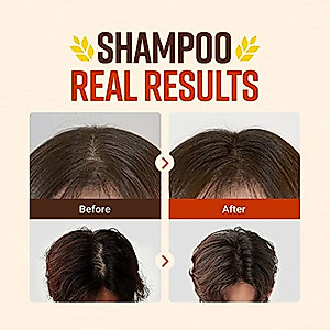 CRAZY SKIN Beer's Shampoo & Hair Pack 3.38 fl.oz Travel Size - Beer Yeast Biotin for Hair Regrowth, Thickening Protein, Keratin, Collagen - Repairing Damaged Tresses