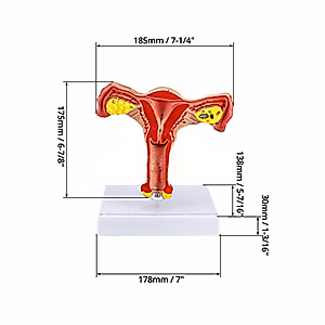 QWORK Human Female Uterus and Ovary Model, Female Genital Organ, Reproductive Organ Model, Uterine Medical Teaching Anatomical Gynecology Uterus and Ovary Model, Human Anatomy Replica