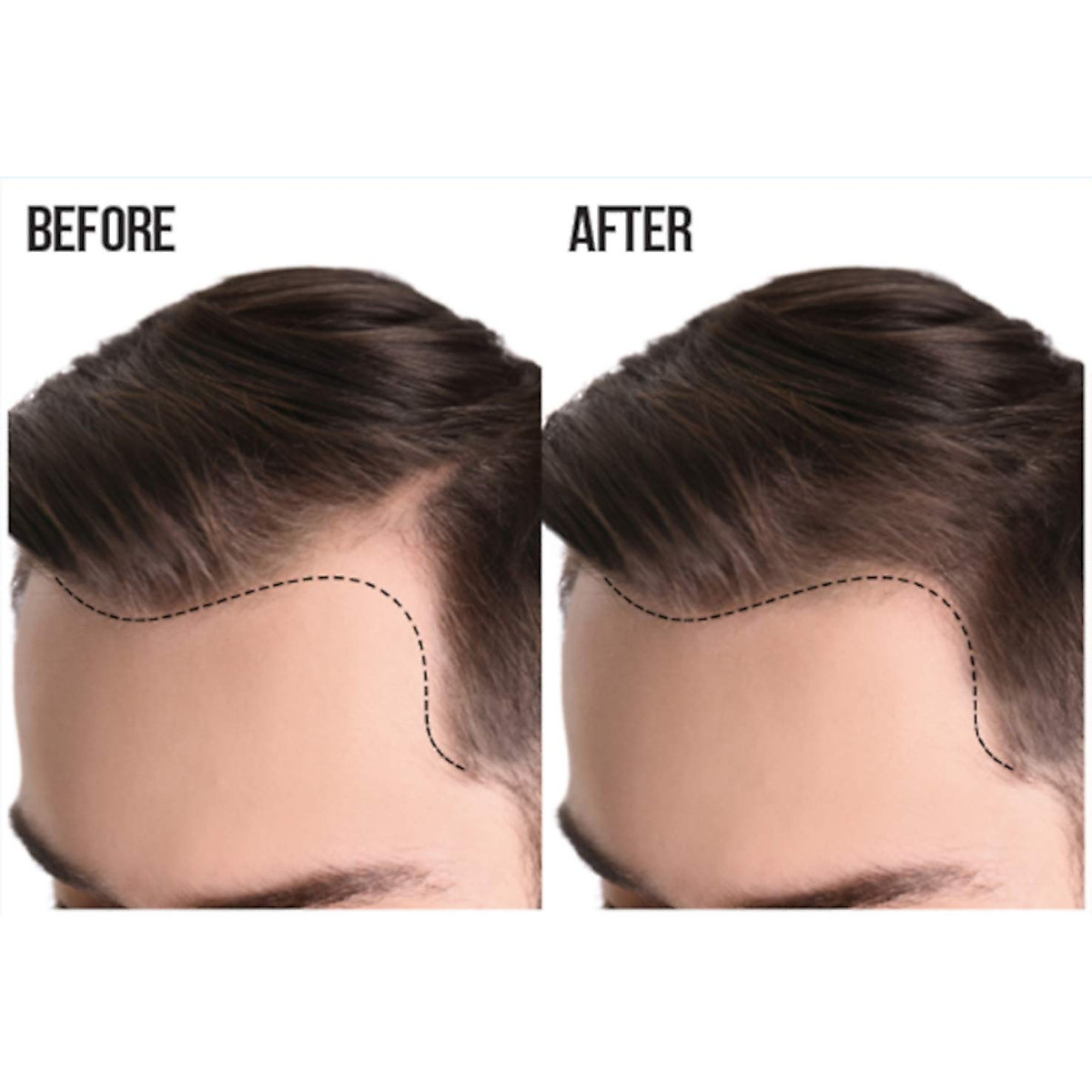 Difeel Mens Ultra Growth Hair and Beard Care Set - 3 Piece Shampoo, Hair Oil and Beard Oil Set