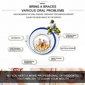 Angzhili 9 Pieces Interspace Toothbrush,End Tuft Orthodontic Toothbrush Tapered Orthodontic Brush for Hard to Reach Areas,Gap Toothbrush for Orthodontic Braces Bridges and Implants