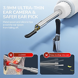 ScopeAround Otoscope, 3.9mm Ultra-Thin Ear Camera with 6 LED Lights, Digital Otoscope with Ear Wax Removal Tool, USB Plug & Play Ear Wax Camera Compatible with iPhone 15/Android