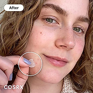 COSRX Acne Pimple Patch Absorbing Hydrocolloid Original 3 Size Patches for Blemishes and Zits Cover, Spot Stickers for Face and Body, Not Tested on Animals, No Toxic Ingredients (240 Count (Pack of 10))