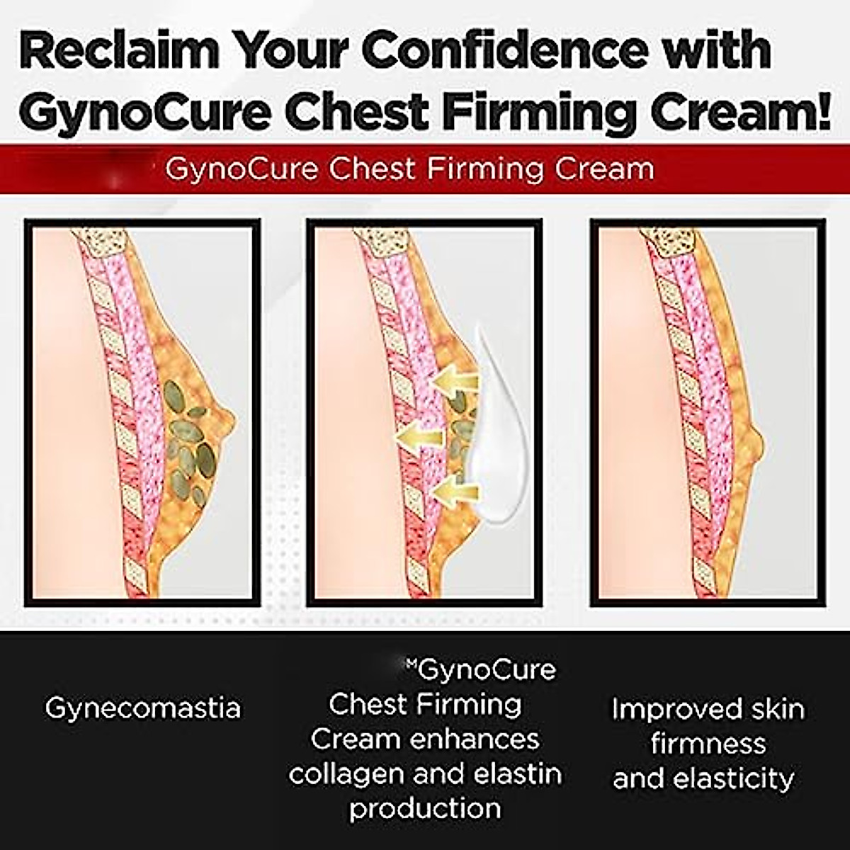 SLPB Gynocure Chest Firming Cream, 60g Gynecomastia Tightening Cream for Men, Hot Cream Anti Cellulite Cream (2Pcs)
