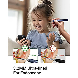 BEBIRD Note5 AuriCare Ear Wax Removal Tool with Ear Camera, Ear Cleaner with Ear Pick &Tweezers Mode,1000W Ear Scope,Universal Gyroscope for Earwax Removal, Ear Wax Removal Kit Include 6pcs Ear Scoop