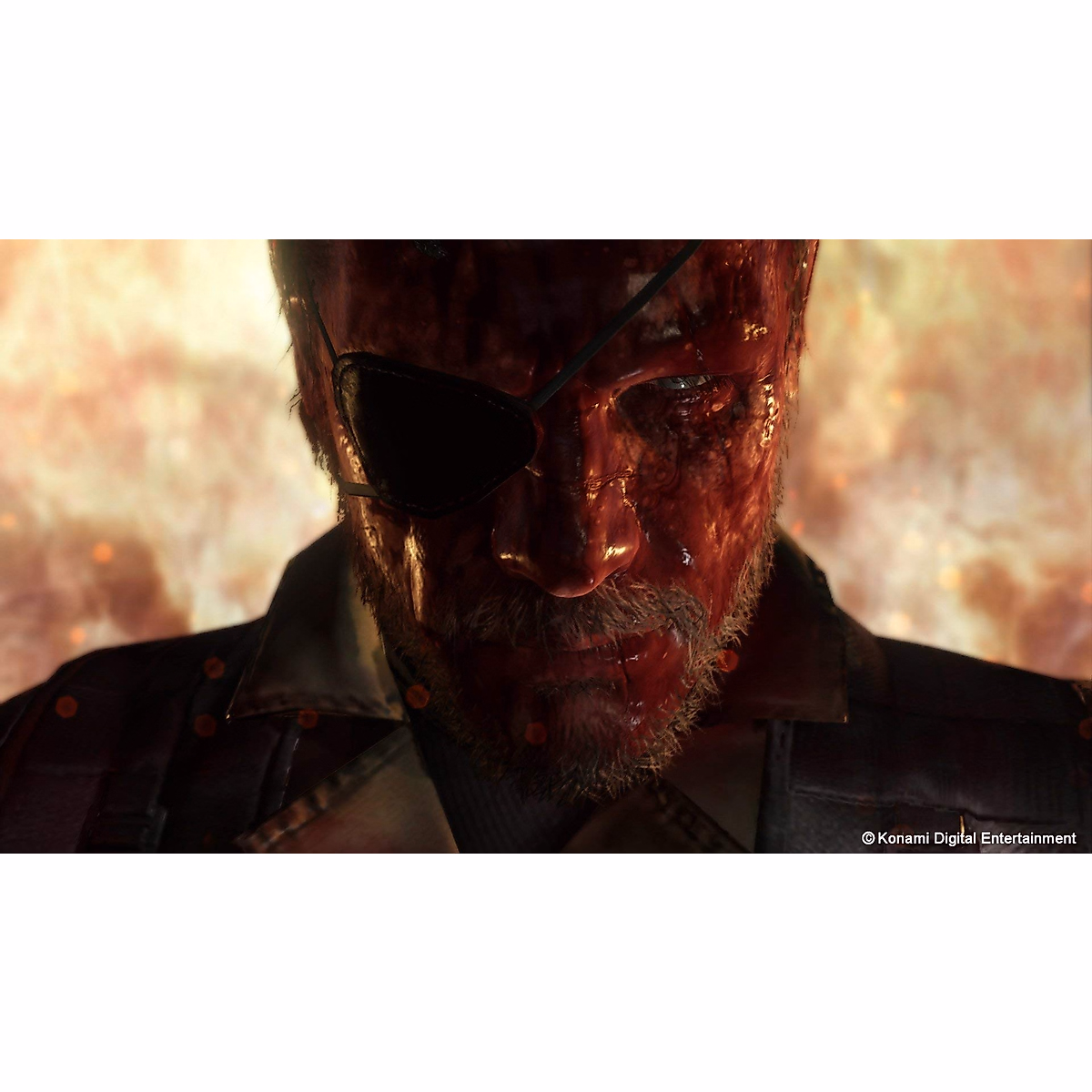 Metal Gear Solid V: The Phantom Pain - Xbox One (Renewed)