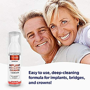 EverSmile OmniFoam Dental Cleaner for Implants, Crowns, and Bridges - Implant Cleaner - Crowns Cleaner - Bridges Cleaner - Dental Crown Cleaner (50 mL) (1 Pack)
