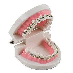 Dental Adult Typodont Demonstration Teeth Model Orthodontic Model Teeth Teach Study Model with Brackets