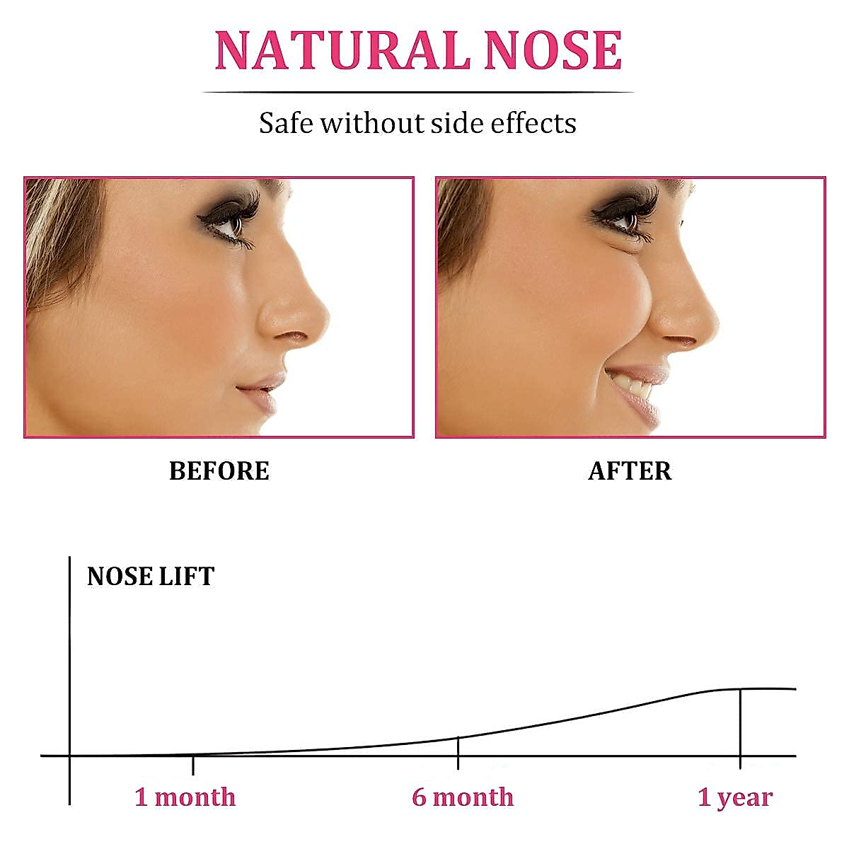 Nose Shaper, Invisible Nose Up Lifting Nose Lifting Shaping Clip Nose 0 Straightening Beauty Tool for Kit Clip Corrector