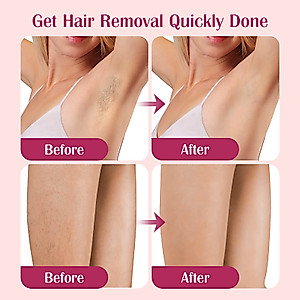 Shinowa Hair Removal Cream, Gel Painless Flawless Depilatory Cream, Gentle Soothing Hair Removal for Women Girl Arms Legs Body Underarms, Suitable for All Skin Types, 1 Pack