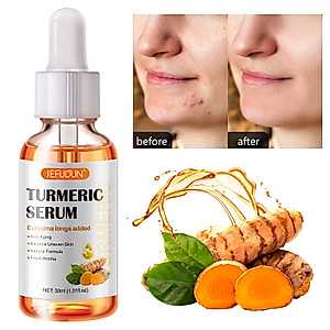 2 Pack Turmeric Serum for Dark Spots, Turmeric Dark Spot Corrector Serum for Acne, Hyperpigmentation and Smooth Skin, Formulated with Hyaluronic Acid, Vitamin C & E - 1.01 FL.OZ