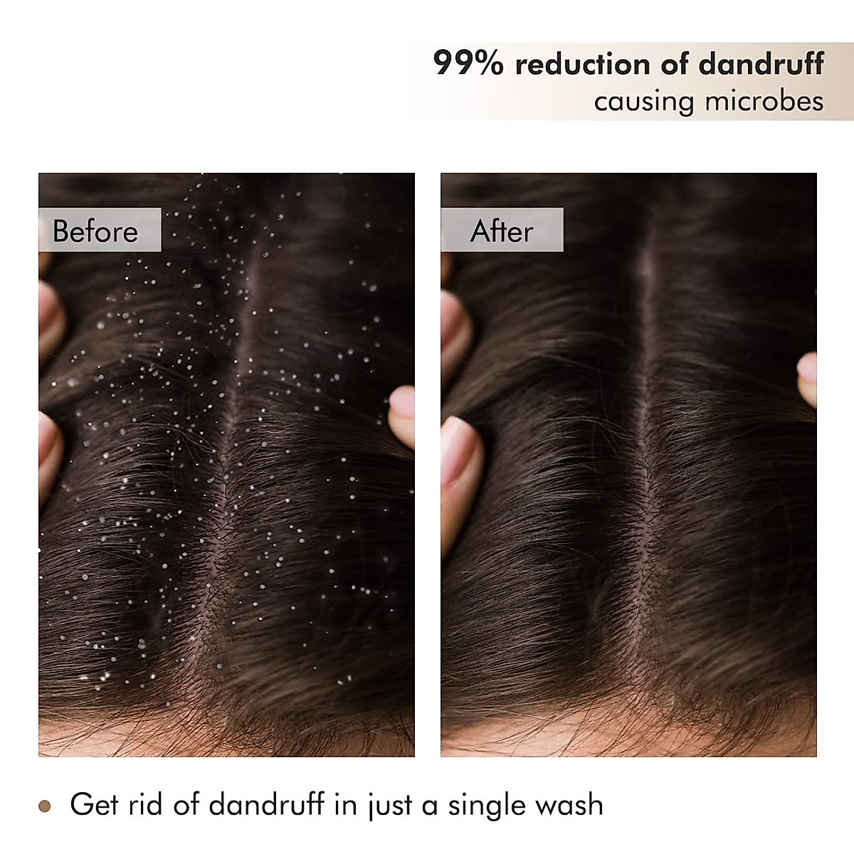 mCaffeine Naked and Raw Coffee Scalp Scrub - Scalp Cleanser Dandruff Removal - Suitable for All Hair Types - Natural Aha - Scalp Exfoliation - 8.82 oz