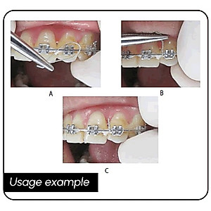 BELEON Braces Wire Orthodontic Dental Ligature Wire for Braces for Home Use Stainless Steel 40g 0.25mm