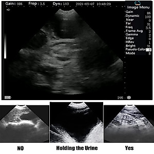 Veterinary B-Ultrasound Scanner Ultrasound Scanner for Pregnancy 6.5 MHz Rectal Probe, for Volume Heart Rate Measurement with 32G TF Card, 8 Color Panels, B/BB/4B Mode for Cattle, Horse, Camel Snake