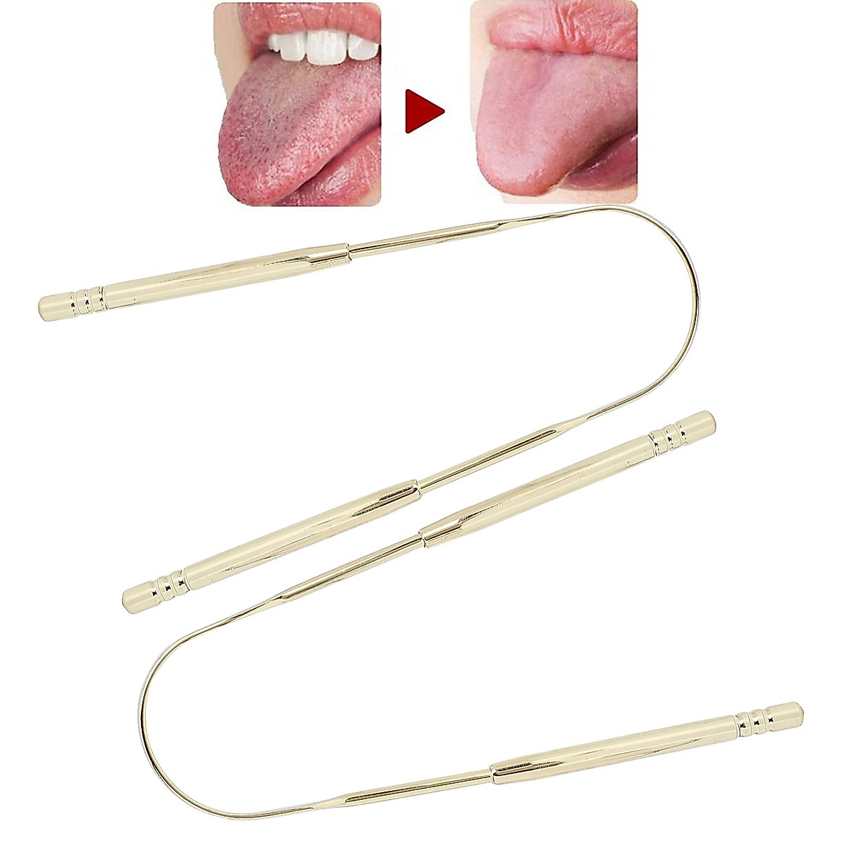 2Pcs Stainless Steel Tongue Scrape, U Shape Tongue Cleaner Oral Tongue Scraper for Oral Care Fights Bad Breath for Adults and Kids(gold)