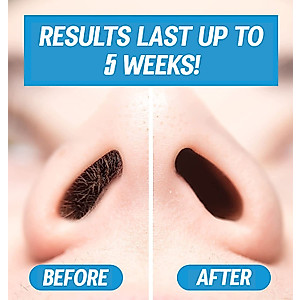 Nose Waxing Wax from Kenashii, 100g / 3.5 oz of Hypoallergenic Wax for Nasal Hair Removal, Specially Formulated to Never Get Brittle or Snap Off in Your Nose, Wipes and Applicators Sold Separately